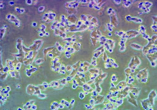 Unique cell lines: GP2d and GP5d | Culture Collections