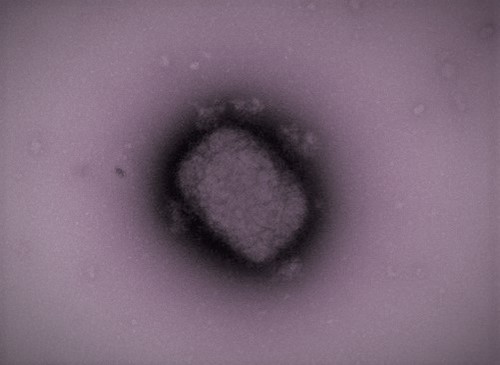 Monkeypox | Culture Collections