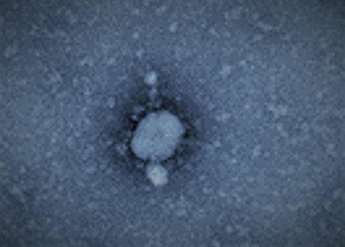 X-Ray inactivated SARS-CoV-2 Wuhan-Hu-1 and SARS-CoV-2 Omicron B.1.1. ...